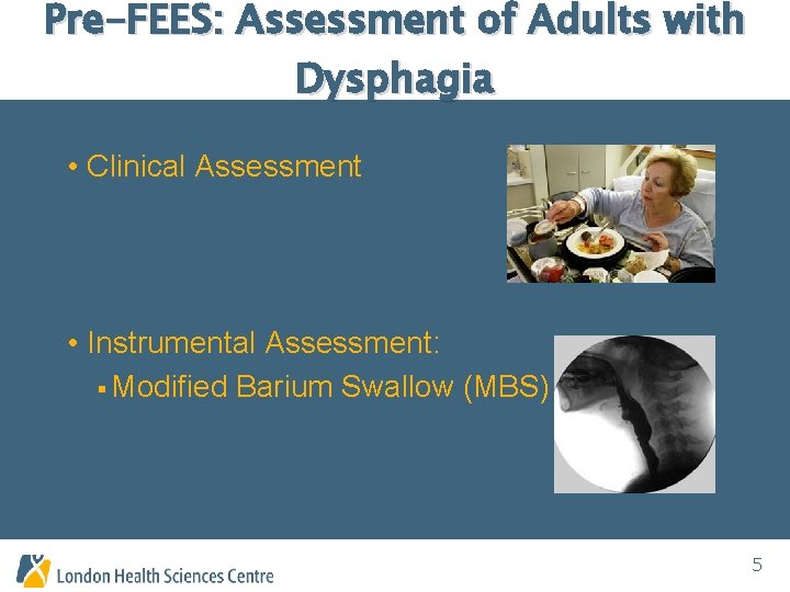 STROKE AND FIBEROPTIC ENDOSCOPIC EVALUATION OF SWALLOWING FEES