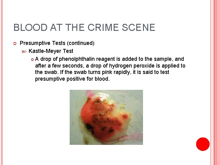 FORENSICS OF BLOOD SUNDAY ACADEMY 2011 12 SEROLOGY
