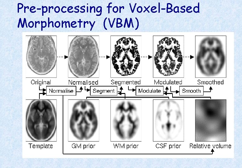 Computational Anatomy VBM and Alternatives Overview Volumetric differences