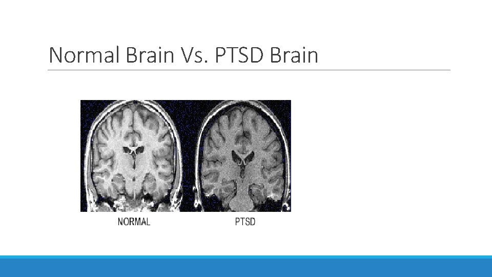 Hard kids New ideas THE COLLABORATIVE PROBLEM SOLVING