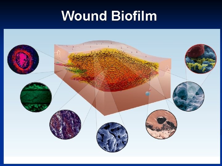 Biofilm Based Wound Care Planktonic vs Biofilm Overview