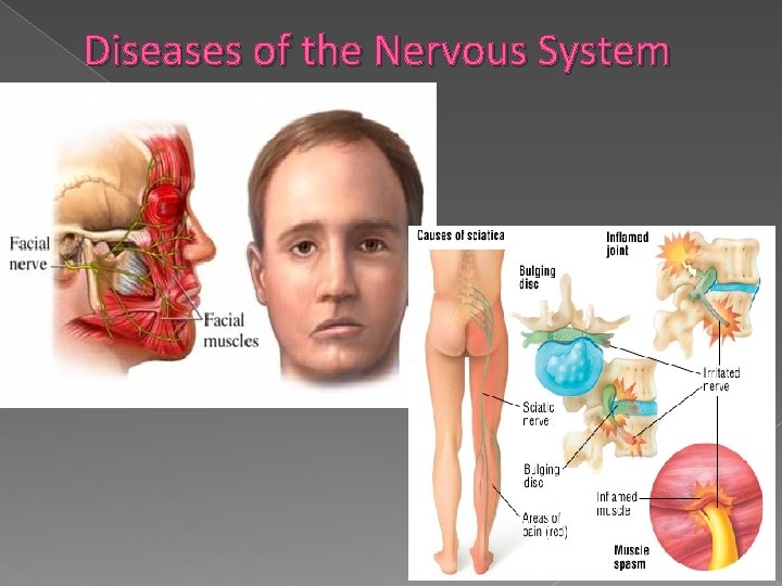 The Nervous System By Rochelle Jones And Diana
