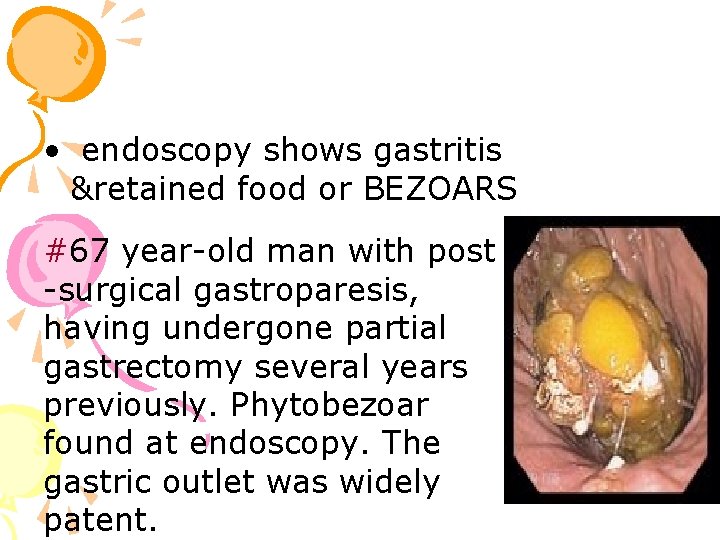 BY REEJA RASHEED REEJA RASHEED 2002 BATCH 2002