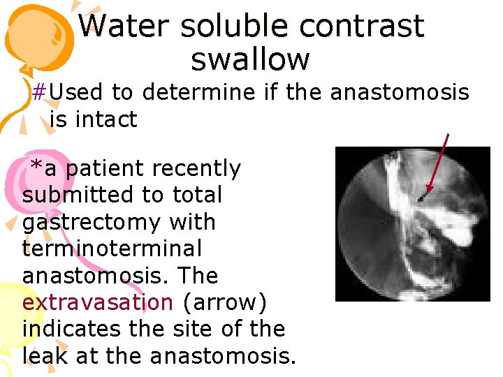 BY REEJA RASHEED REEJA RASHEED 2002 BATCH 2002