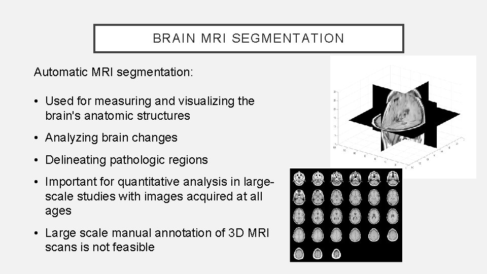 Automatic Segmentation Of Mr Brain Images With A