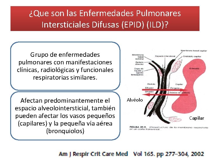 REHABILITACIN RESPIRATORIA EN ENFERMEDAD PULMONAR INTERSTICIAL DIFUSA Lic