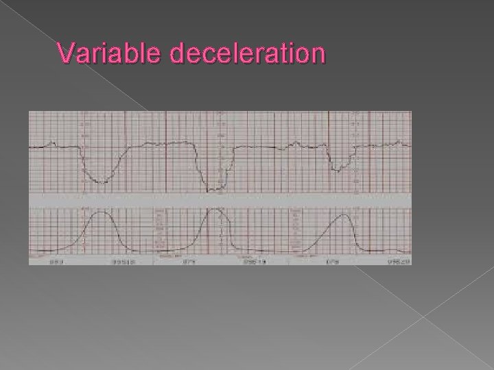 Labor and the Birth Process The 5 Ps