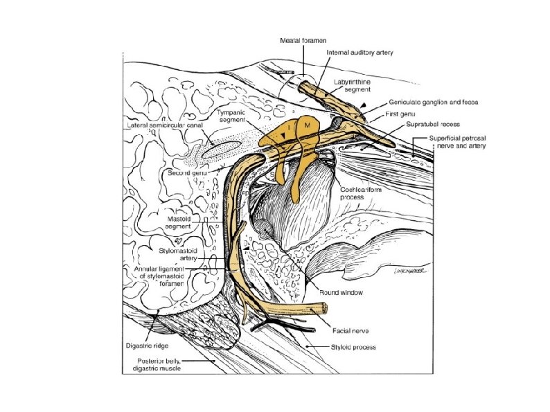 Cummings Ch 127 Tbone And Ear Anatomy Sameer