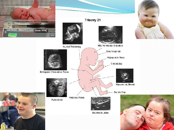 BOLI CROMOZOMIALE Anomalii cromozomiale CLASIFICARE In functie de