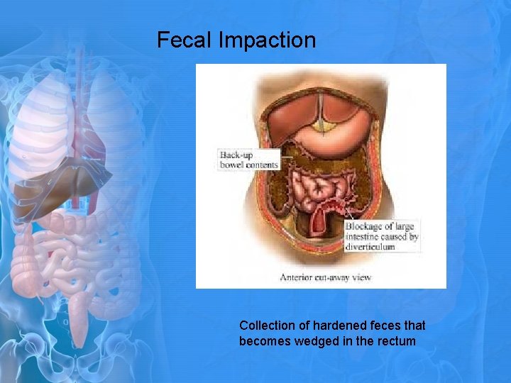 Bowel Elimination B 260 Fundamentals of Nursing SCIENTIFIC