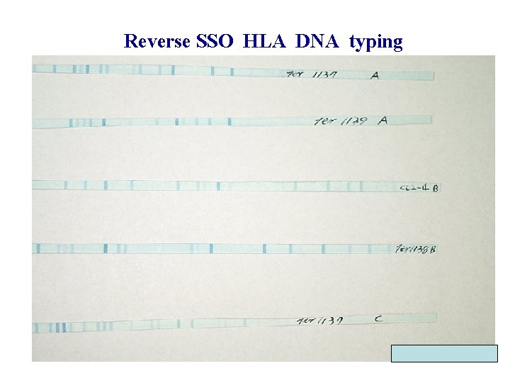 HLA MHCMajor Histocompatibility Complex Highly polymorphic genes Recognition