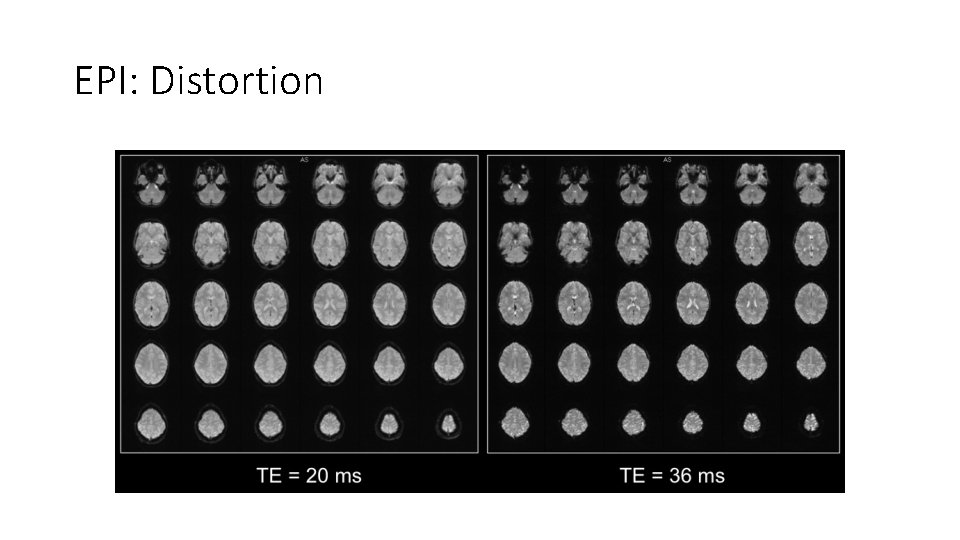 f MRI Data Preprocessing Brainhack ATL Eswar Damaraju