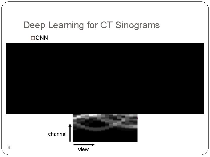 Deep Back Projection For Sparseview CT Reconstruction Dong Deep Back Projection For Sparseview CT Reconstruction Dong