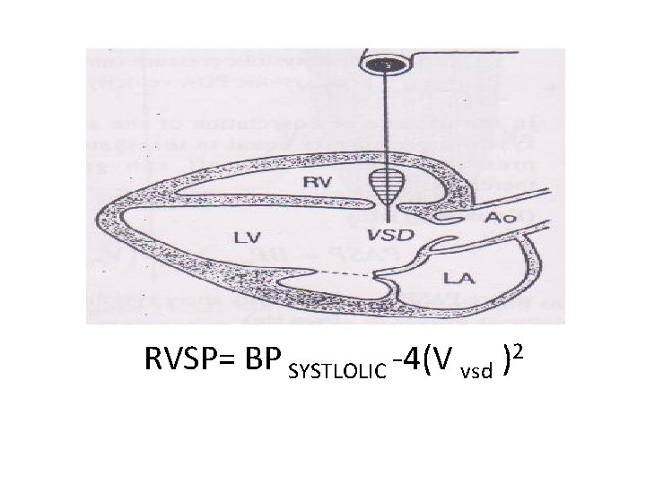DOPPLER ECHOCARDIOGRAPHY1 BASIC PHYSICS PULSE WAVE AND CONTINUOS