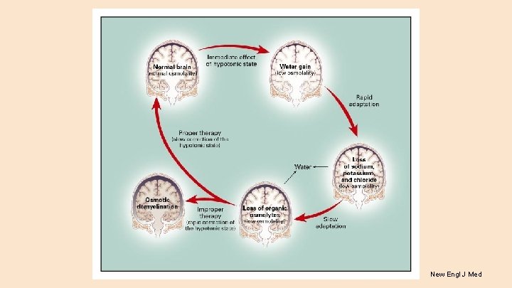 Water Homeostasis Hyponatremia James Brandes M D Carroll