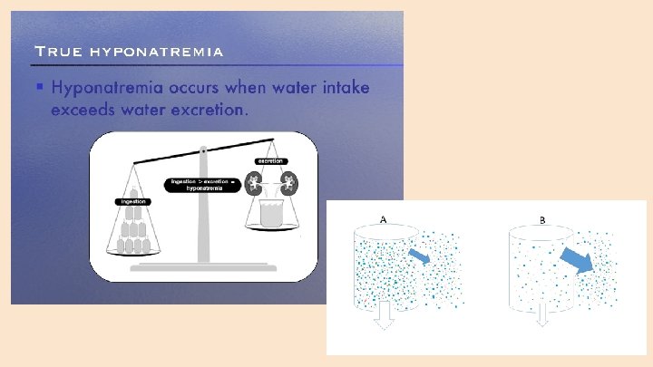 Water Homeostasis Hyponatremia James Brandes M D Carroll