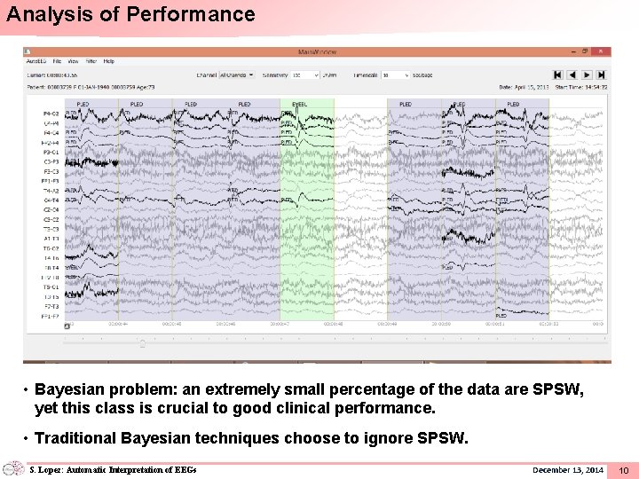 THE TUH EEG CORPUS A Big Data Resource
