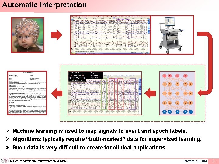 THE TUH EEG CORPUS A Big Data Resource