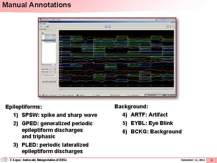 THE TUH EEG CORPUS A Big Data Resource