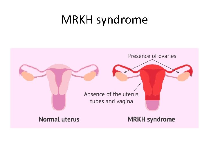 Genital Organs Embryology Secondary sex organs Secondary genital
