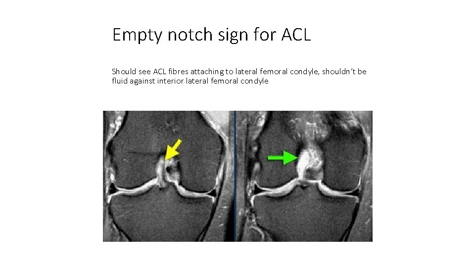 Mri Mri Tips T 1 Scanshort Numbers 1