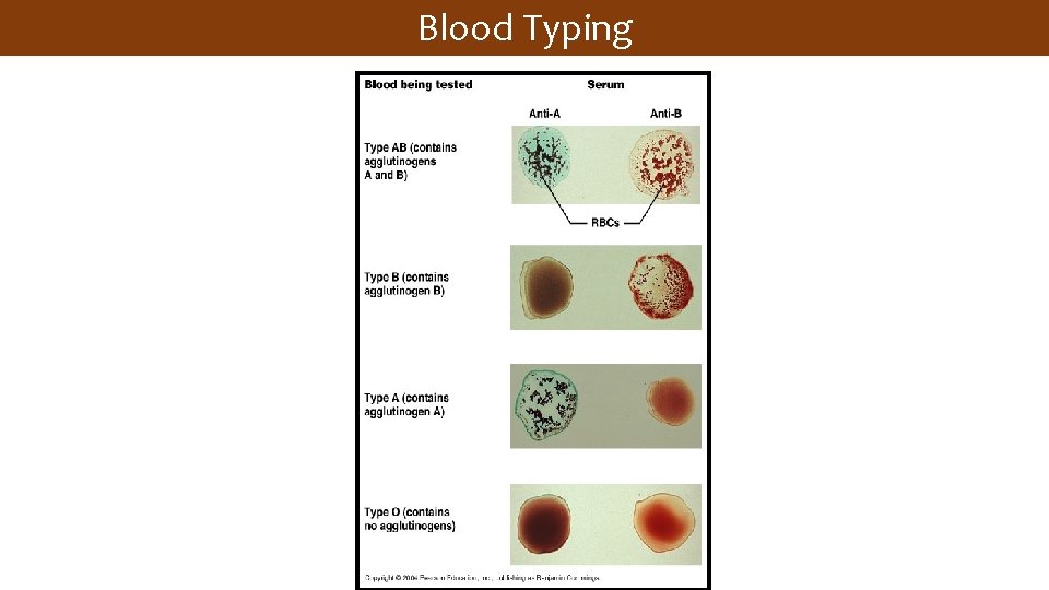 Blood transfusion Physiology By Dr Sunita Mittal Learning