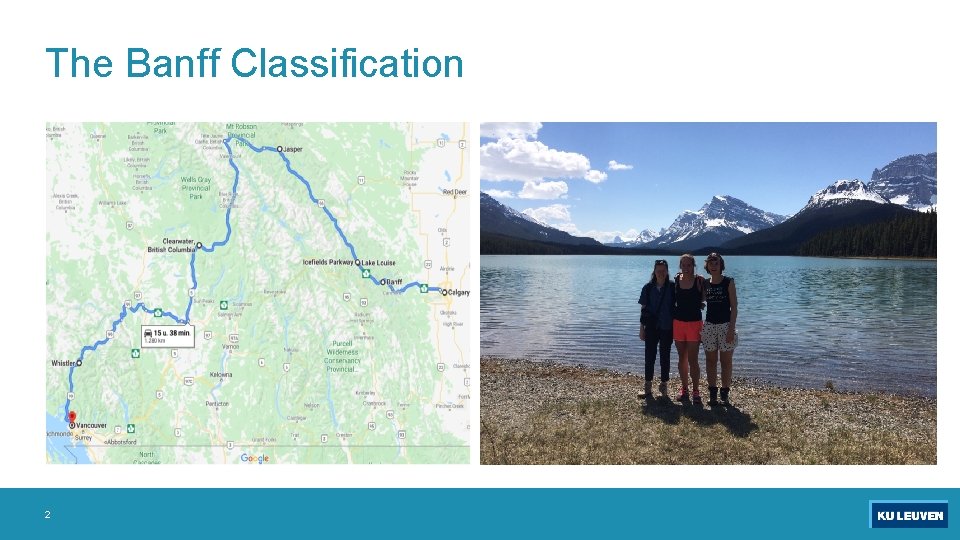 The Banff Classification of AcuteActive Antibody Mediated Rejection