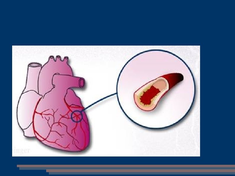 Bolest na hrudi tonut MUDr Luk Dadk ARK