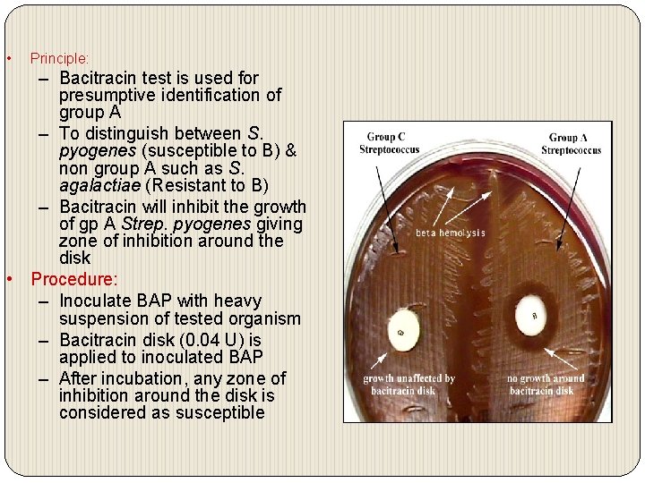 Respiratory Block Practical 2015 Streptococcus Pyogenes Group A