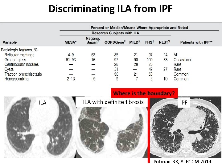 ILA interstitial lung abnormalities prevalence and clinical relevance