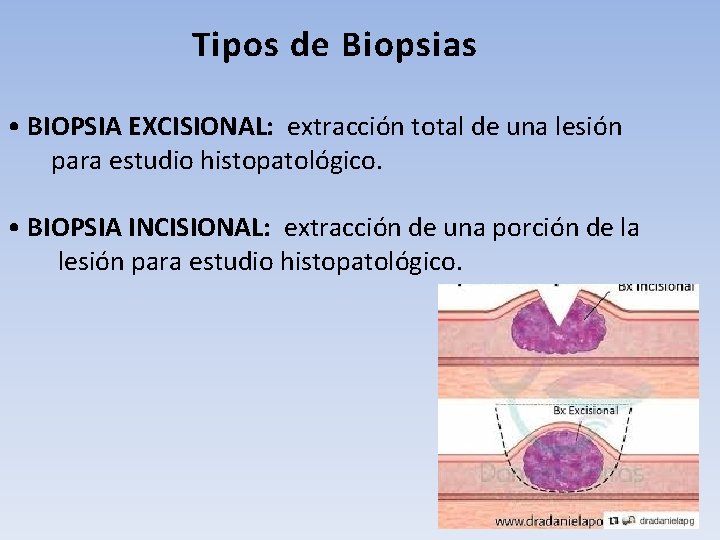 Toma de Biopsia y manejo de la muestra