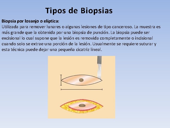 Toma de Biopsia y manejo de la muestra