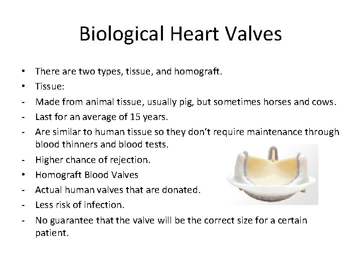 Artificial Heart Valves By Daniel Wec What are