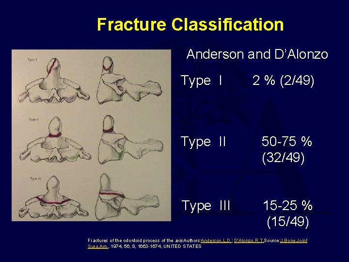 Upper Cervical Spine Fractures Originally created by Daniel