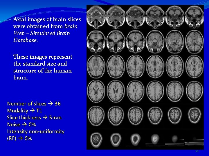 Brain Phantoms for Ultra High Field MRI Sixweek