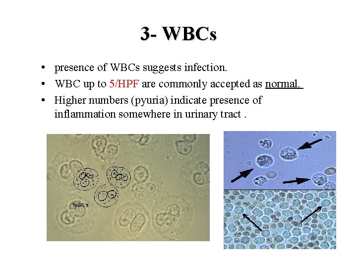 Lab 10 Routine Urine Analysis Microscopic Analysis of