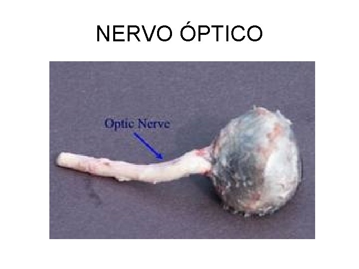 TRABALHO DE ANATOMIA NERVO PTICO Anderson Sonza Jorge