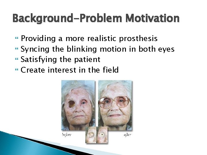 Blinking Orbital Prosthesis Hallie Kreitlow Joel Gaston Ryan