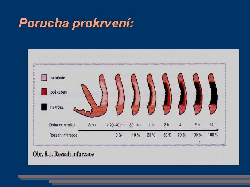 Bolest na hrudi tonut MUDr Luk Dadk ARK