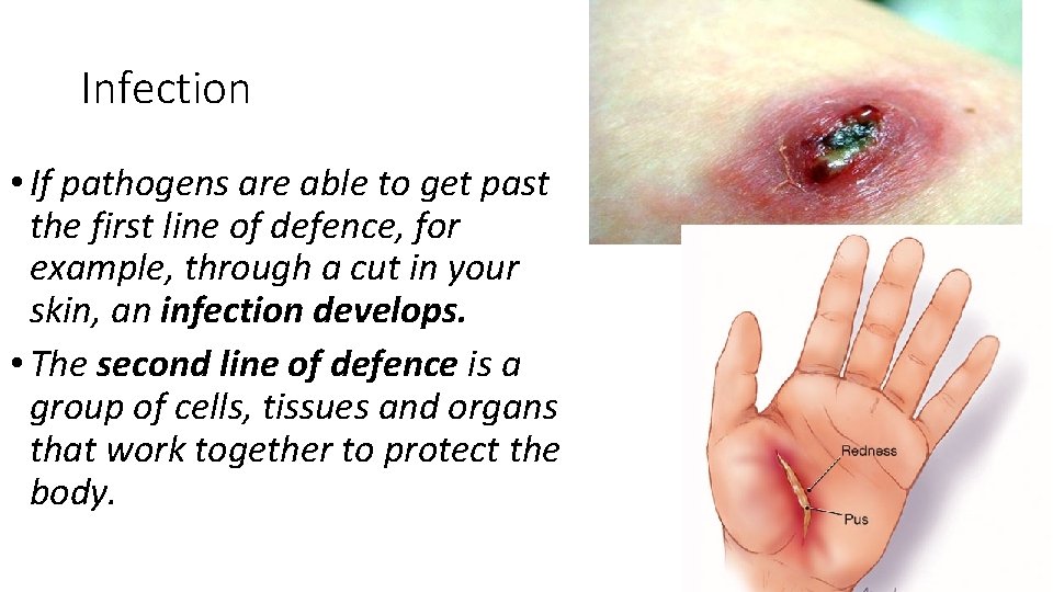 How does the Body Protect Itself The immune