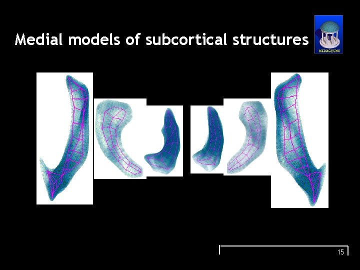 Statistics of Shape in Brain Research Methods and