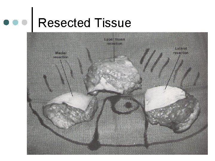 Breast Pedicle Protector Kuya Takami Joseph Yuen Nathan