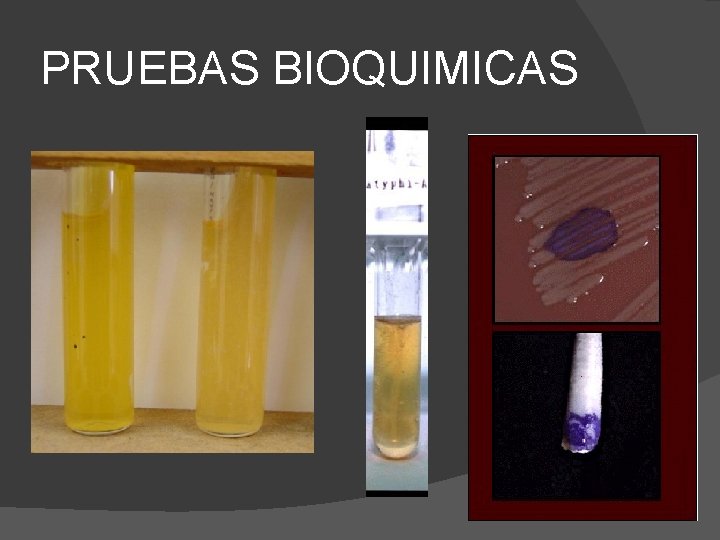 IDENTIFICACION BACTERIANA II CLASE N 3 Lic Mara