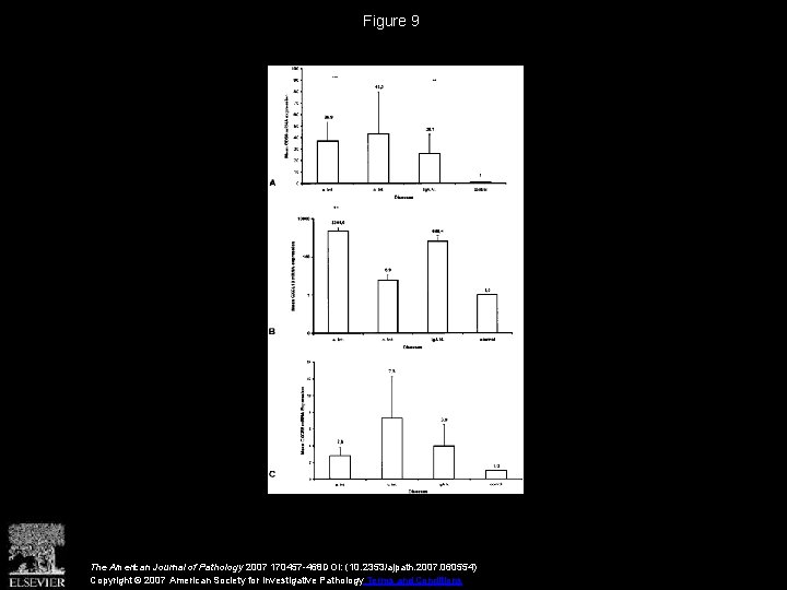 The Contribution Of B Cells To Renal Interstitial