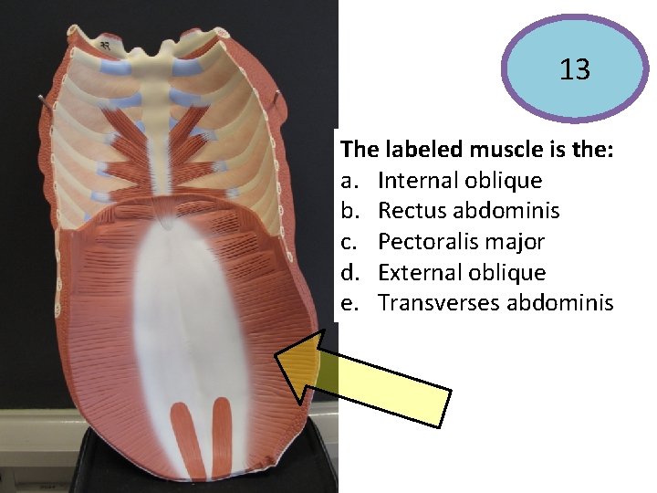Muscle Practice Quiz 1 The labeled muscle functions