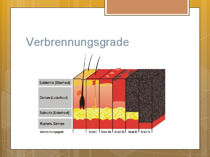 Thermische Wunden Dr Feilke Tiologie Verbrennungen Erfrierungen Stromunflle thermische-wunden-dr-feilke-tiologie-verbrennungen-erfrierungen-stromunflle