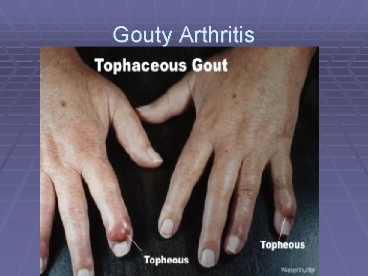 Chapter 7 8 Bones Joints Long bone structures
