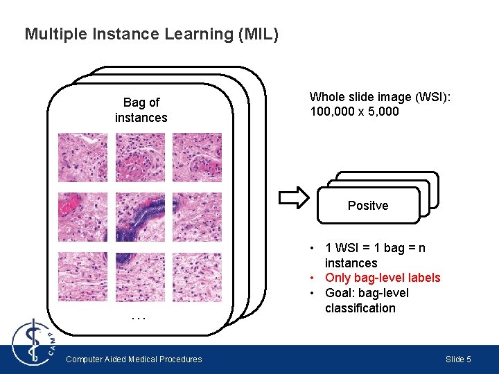 Predicting Lymph Node Metastasis Using Histopathological Images Based