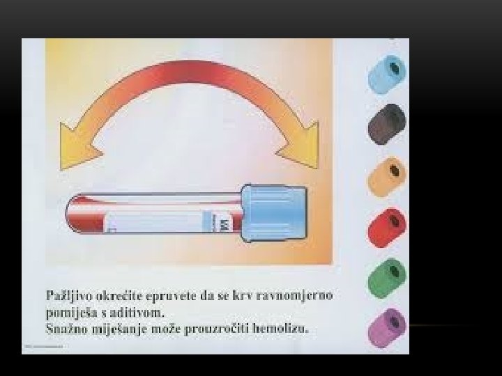 UZIMANJE UZORAKA VENSKE KRVI KOJI PRIBOR TREBAMO ZA