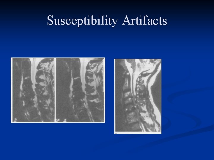 Basic MRI Chapter 1 Lecture Introduction MRI uses